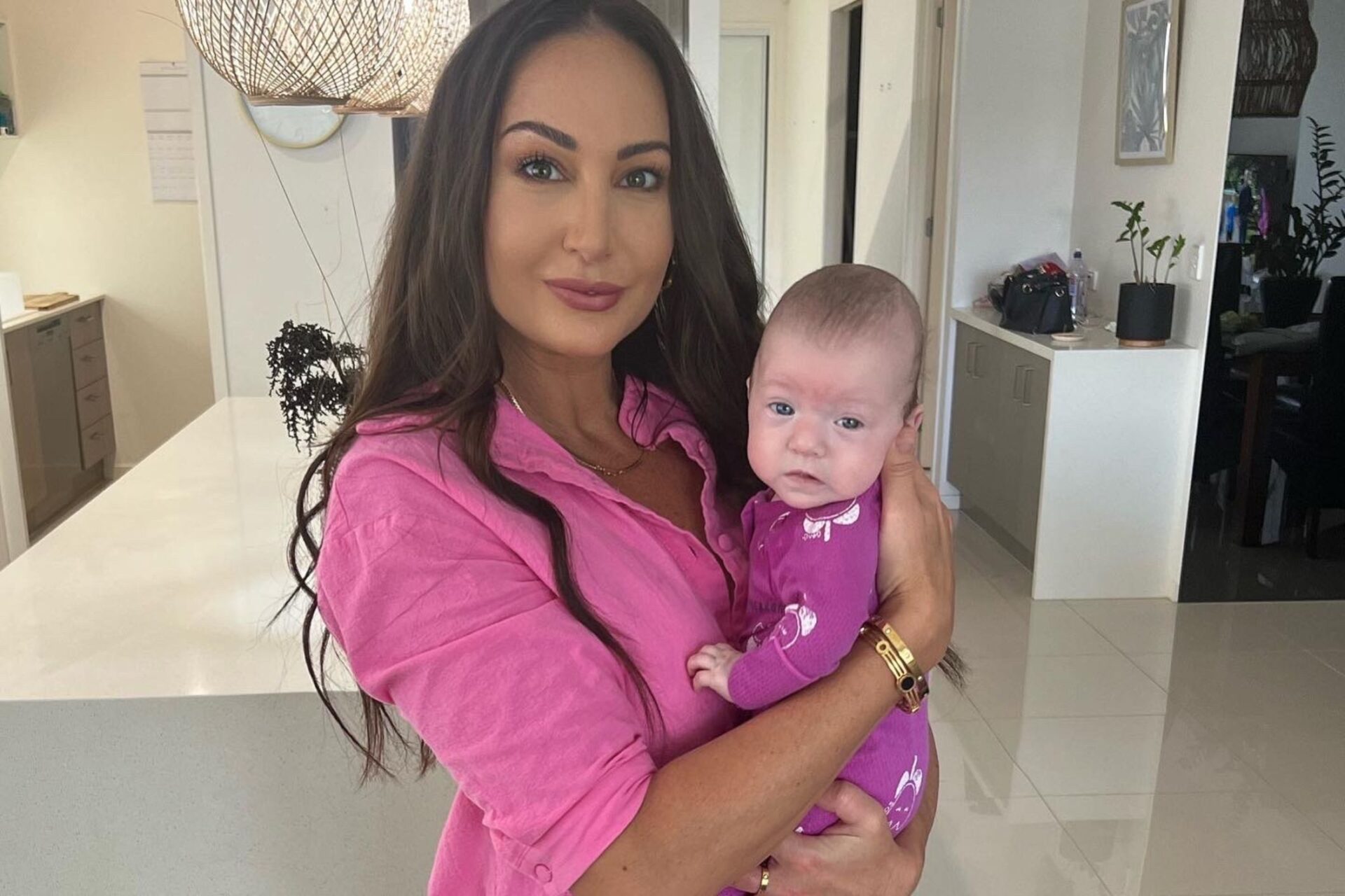 ‘Such a fighter’: baby amazes doctors and parents