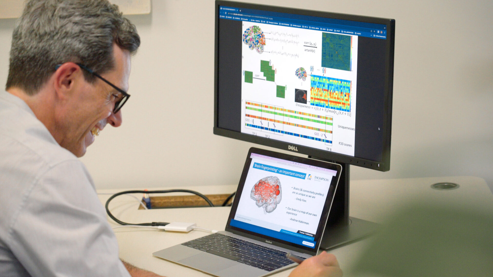 Ground-breaking brain study hits milestone