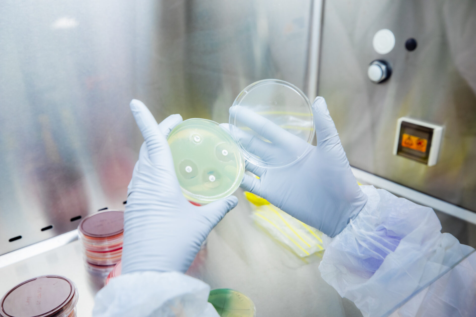 Study aims to improve treatment of chronic lung disease