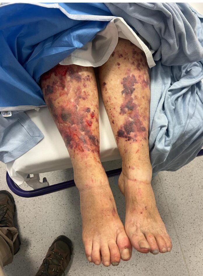 Woman missing in national park found safe and well